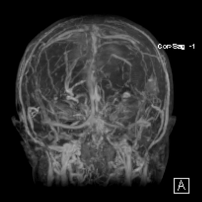 NF2 Image Collection