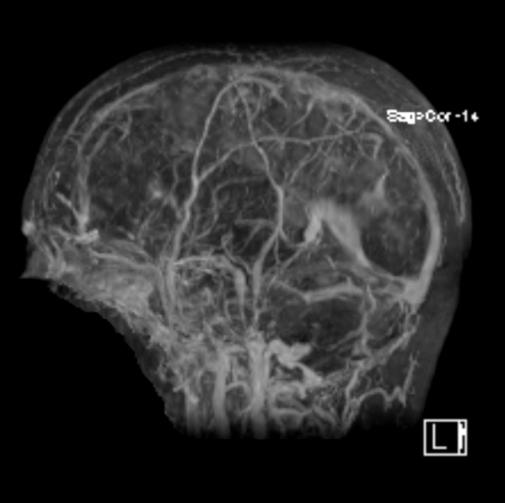 NF2 Image Collection